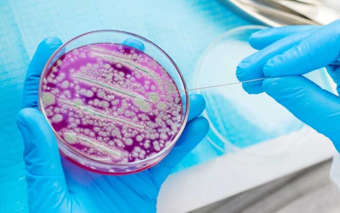 DEADLY Superbug SPREADS — 27 States Hit | Right is Right