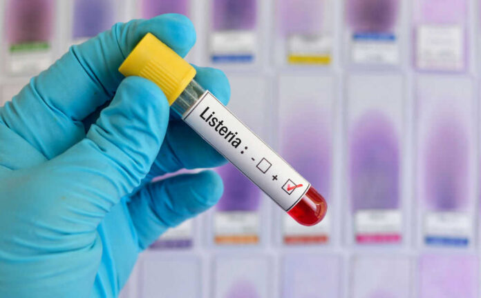 Deadly Listeria Triggers Total Recall | Right is Right